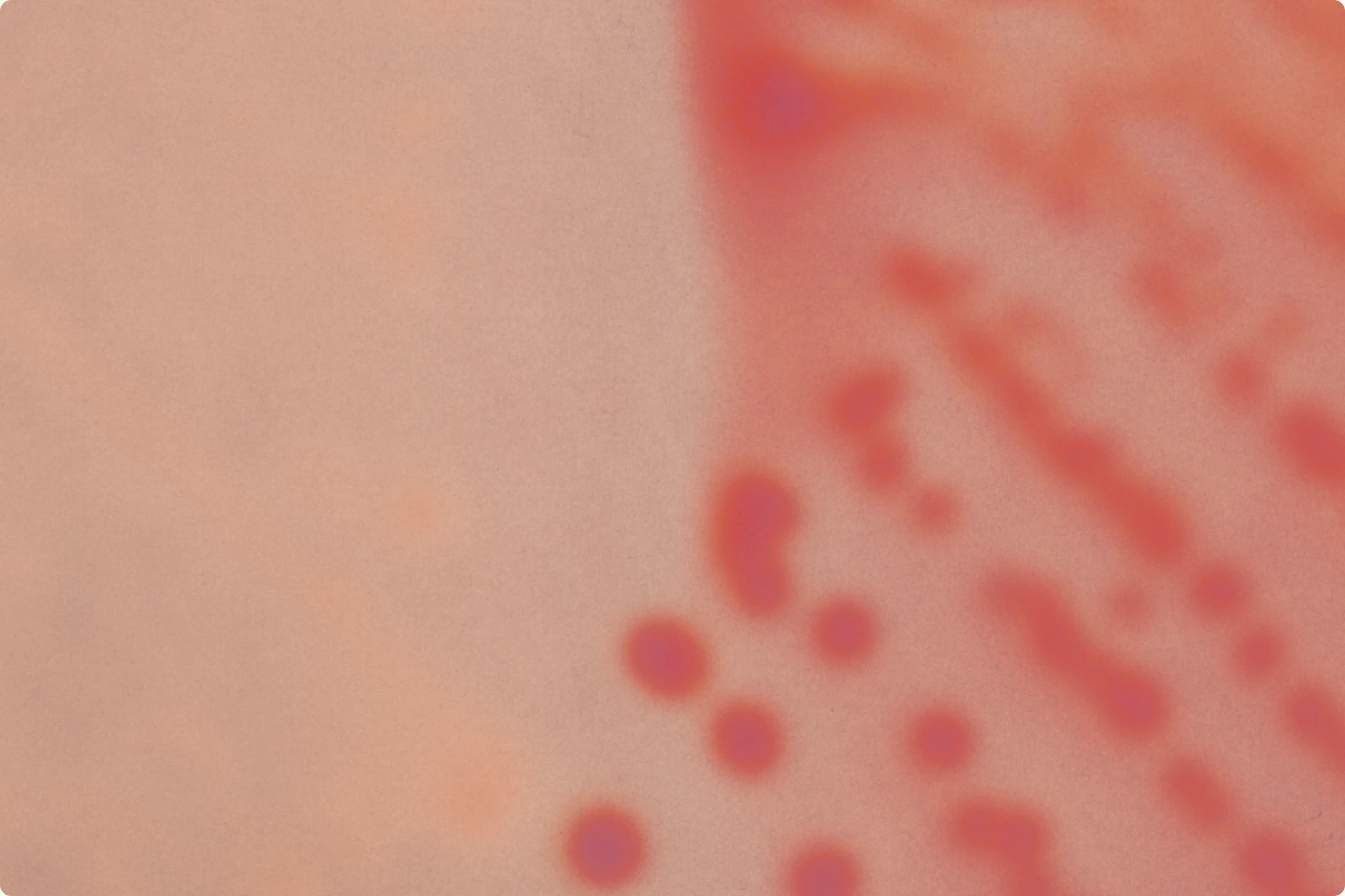 Can a yeast infection cause bloody discharge store